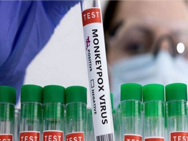 14th monkeypox case reported in India, 9th in Delhi: Official sources