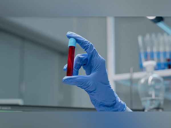 Kindly launches first Indian lab tests with At-home Collection for ...