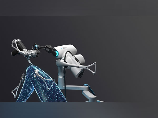 Care CHL Hospitals brings Cutting-Edge Velys Robotic System For Total ...