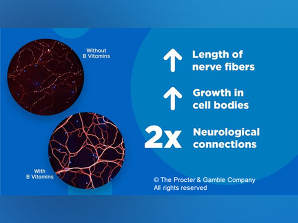 Neurobion Dons the Purple Ribbon to Commemorate Nerve Health Awareness ...