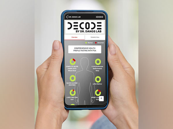 Dr Dangs Lab Launches "Decode", an Innovative Digital Smart Report Platform