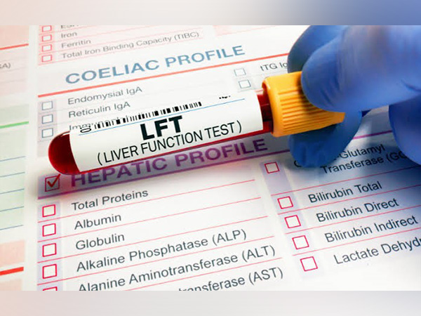 When Should You Get Liver Function Tests Done? Signs and Symptoms that ...