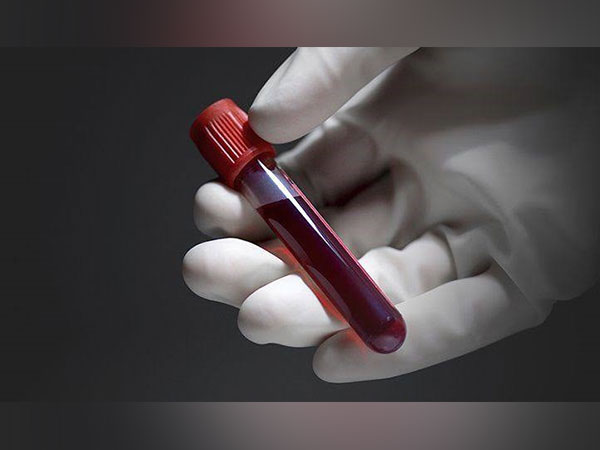 Which Blood Test Can Help Detect Infections? Which Blood Test Can Help Detect Infections?