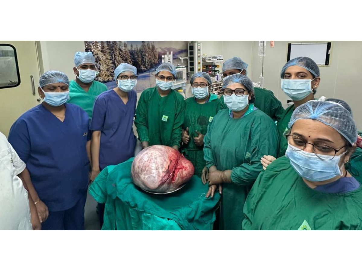 Successful Removal of 18 kg Ovarian Tumour from 68-Year-Old Woman