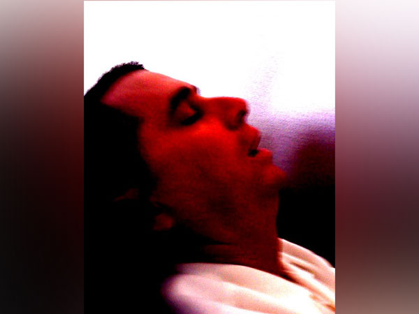 Snoring is in your genes, says a new Study