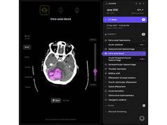 Aarthi Scans adopts Australian AI technology to elevate patient care ...