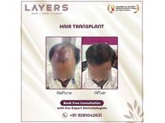 Rapid Nationwide Expansion: Layers Skin and Hair Clinics Continues to ...