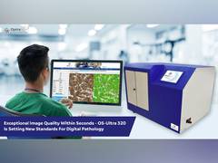 OptraSCAN unveils OS-Ultra 320, first-ever high-speed scanner at ...