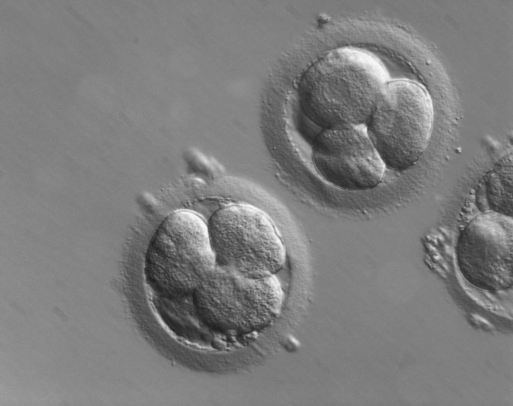 AI 'Stork' can help scan IVF embryos for faster implantation