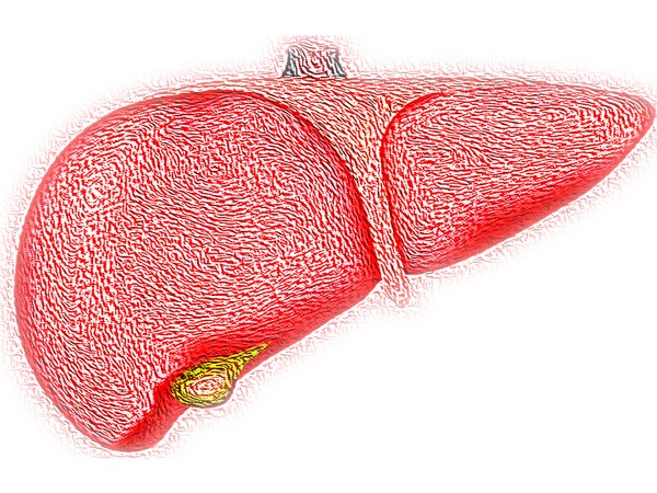 Highly accurate non-invasive test for major liver diseases created by ...
