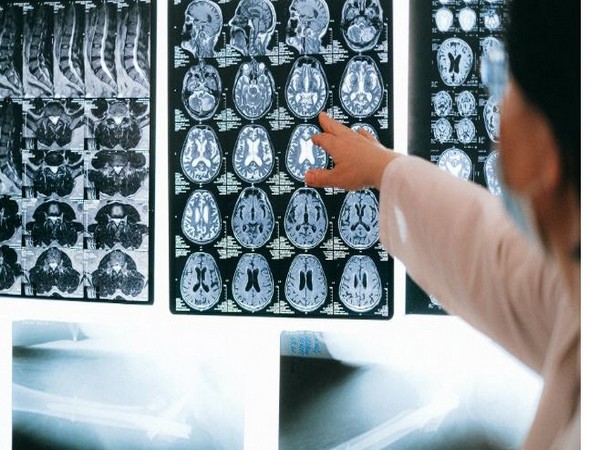 New study images ballistic wounds, bullet composition and implications ...