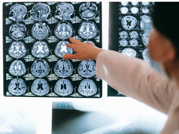 Scientists use machine intelligence to accelerate brain mapping technique