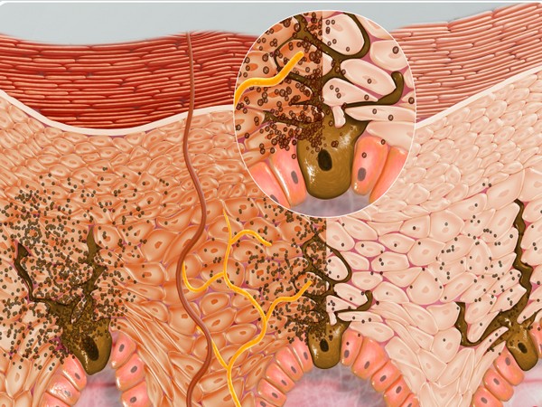 Here is how sun damages our skin: study